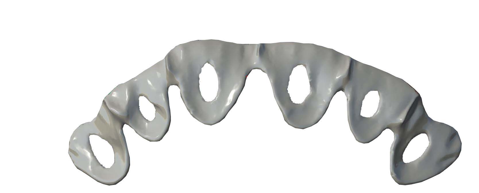 why Brite aligners – Brite Aligners